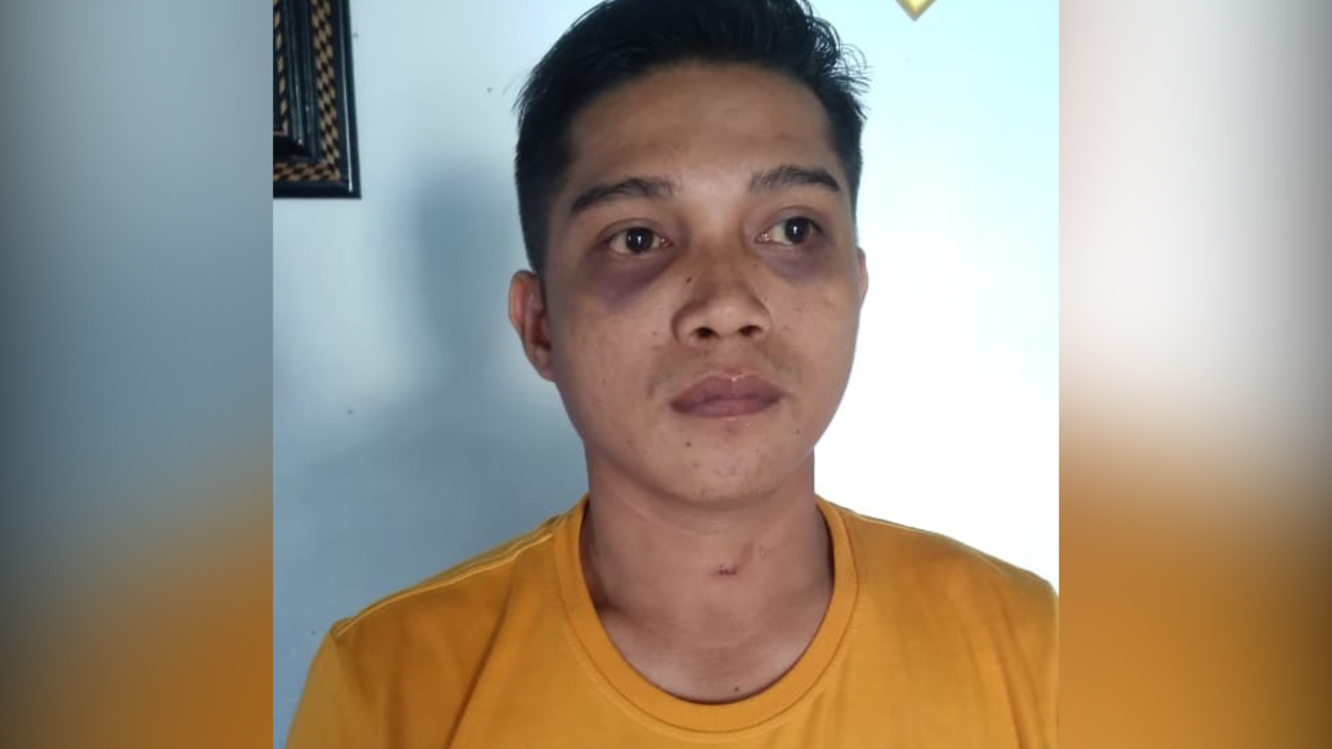 Seorang Pria di Boalemo Mengaku Dianiaya Oknum Polisi